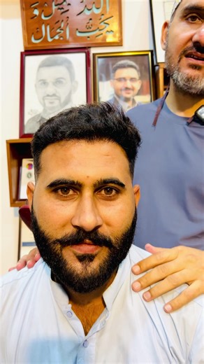 ✨ Hair Transplant 6-Month Results! 🌟 Super Natural Look with FUE Method | Dr. Habib Check out this incredible 6-month hair transplant transformation! 💯 Achieve a natural look with the FUE method at Dr. Habib's Clinic. 💇‍♂️ #HairGoals #FUETransformation #HairTransplantJourney #6MonthsResults #FUEHairTransplant #NaturalResults #PeshawarClinic #DrHabibMagic #HairTransformation #BeforeAndAfterHair #HairRestoration #PeshawarHairClinic #HealthyHair #GlowUp #ConfidenceBoost #HairCareJourney #WhatsAp