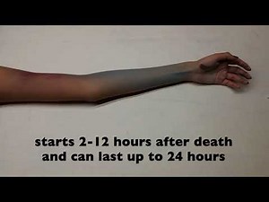 stages of a body after death