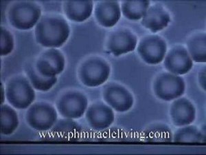 live blood cell analysis dr. Robert Young