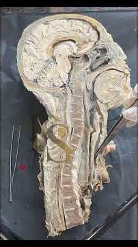 #anatomy #trachea #oesophagus #mouth #windpipe #shortsvideo