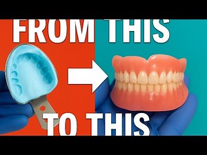 From Impression to Smile 😍 How Dentures Are Really Made”