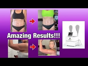 HIEMT Results!! | AMAZING Results from HIEMT | EMSCULPT AT HOME!!