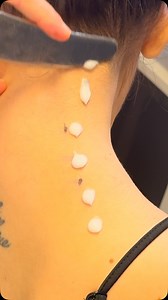 🏆 IASTM (Instrument-Assisted Soft Tissue Mobilization) uses specially designed tools to break up scar tissue, reduce muscle tightness, and improve mobility. It’s especially helpful for overuse injuries, post-surgical recovery, and areas that feel “stuck” no matter how much you stretch. 🏋🏽‍♂️🏌🏻‍♀️🏃🏾‍♂️ — Dr. Kyle Ross #IASTM #SoftTissueTherapy #ChicagoChiropractor #DrKyleRoss | Dr_kyleross