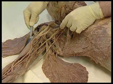 Dissection du corps humain, commentée : Épaule région axillaire et bras vue ventrale