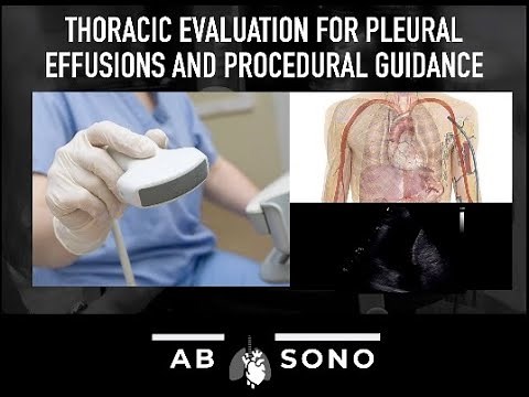 Thoracic evaluation for pleural effusions and procedural guidance