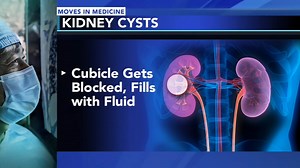 Fox Chase study aims for better identification of aggressive kidney masses