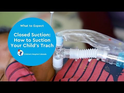 Tracheostomy Care: How to Closed Suction Your Child's Trach