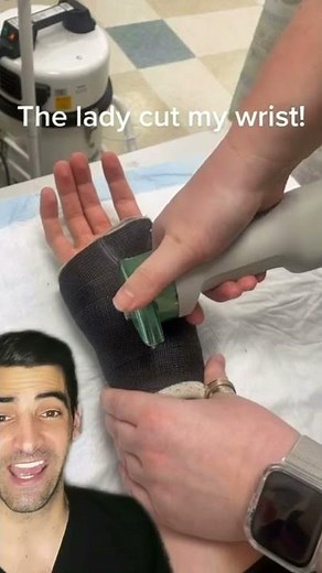 Cast removal after fracture