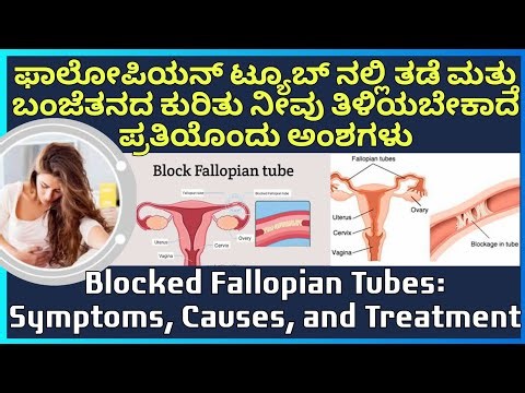 Blocked Fallopian Tubes: Symptoms, Causes, and Treatment