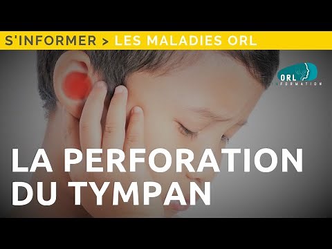Perforation du tympan | Information patient