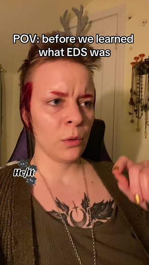 #eds #ehlersdanlos #ehlersdanlossyndrome #heds #connectivetissuedisorder #zebra #spoonie #chronicillness #chronicallyill #chronicpain #disabled #disability