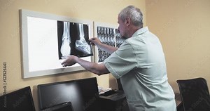 Male doctor reviewing x-ray 4k video. Orthopedist puts xray leg foot scan image on illuminator panel and searching diagnosis