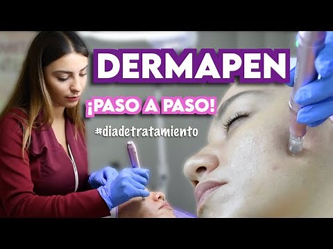 DERMAPEN || MICRONEEDLING TREATMENT - Ximena Ramaya
