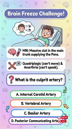 Basilar Artery Stroke #usmle #meded #shorts