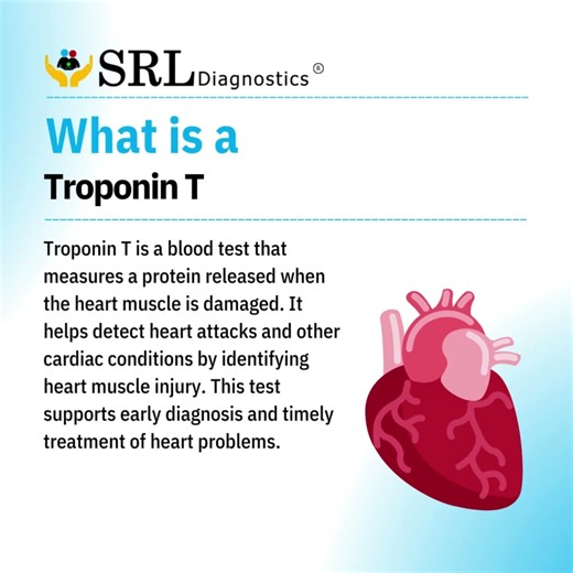 🧠 Understanding Troponin T: What the Numbers Tell You #TroponinT #SRLDiagnostics
