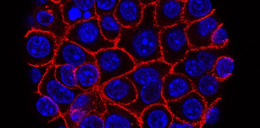 Triggering cancer cells to become normal cells – how stem cell therapies can provide new ways to stop tumors from spreading or growing back