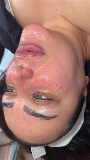 Experience Radiant Skin with OxyGeneo Facial