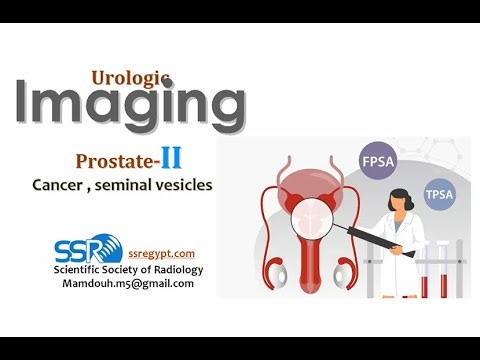 10- Imaging of the prostate TRUS ,CT, MRI (II) - Prof Mamdouh Mahfouz