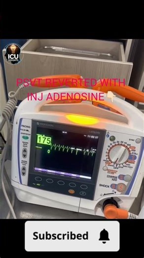 #PSVT Reverted with Inj #Adenosine | #Emergency #Cardiology | #ICU Insights