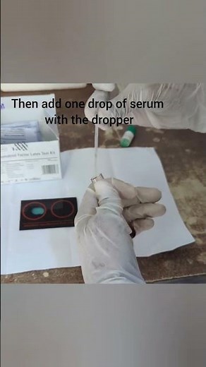 How To Do RA Test (Rhematoid Arthritis) By Latex Agglutination Method #RAfactor #pathology