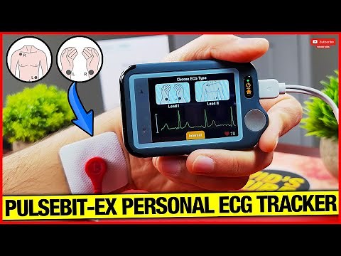 Pulsebit EX Personal ECG/EKG Tracker Wellue Viatom!
