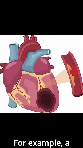 The Heart’s Anatomy and What It Means for Your ECG