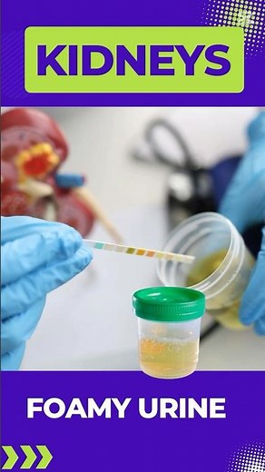 Foamy or Bubbly urine