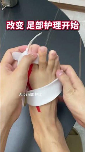 Step by Step Bunion Splint Demo