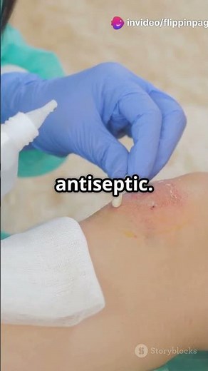 Quick First Aid for Cuts: Step-by-Step Guide!