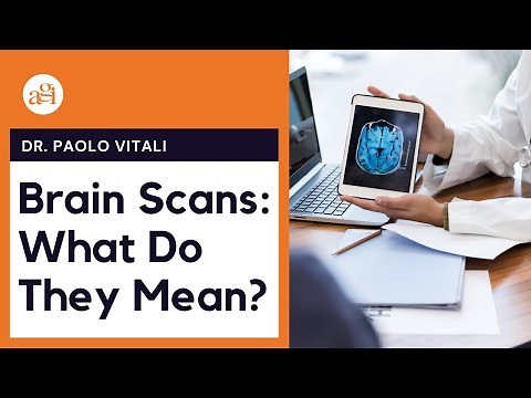 Brain Scans and Tests Explained by a Doctor | Alzheimer's | Dementia