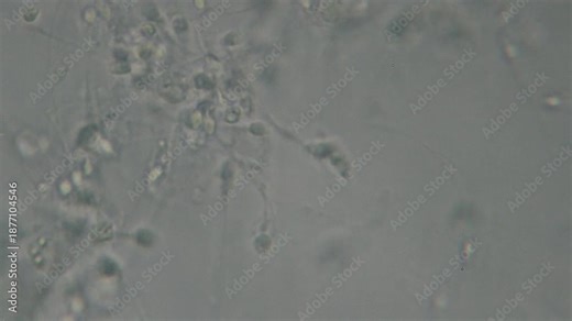 Microscopic view of moving human sperm cells with visible heads and flagella against a light background, commonly used in fertility and reproductive studies.