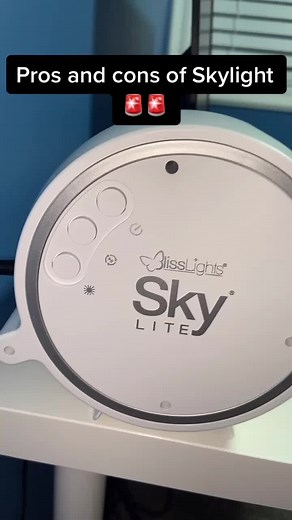 The Ultimate Guide to Skylight: Pros and Cons Unveiled