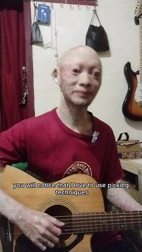 Learn Basic Picking Patterns for Guitar | Guitar Tutorial