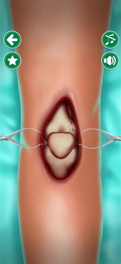 Surgery Simulator Doctor Games #gamer #android #mobilegames #reels #viralvideo1million #viralvideostiktoks #foryou #surgery #gameplay #gaming #gamertiktok