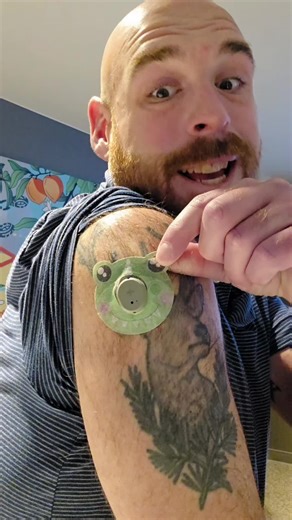 Experiencing a Dexcom Change: A Personal Insight