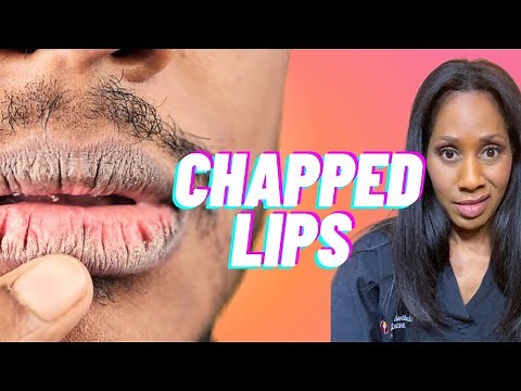 How to Heal Chapped Lips FAST | A Doctor Explains