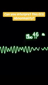 Can you you interpret ECG ? | Medical Talks