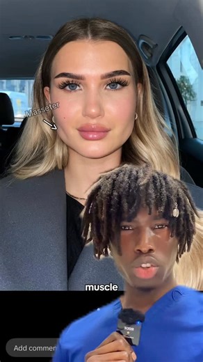 Don Starke on Instagram: "How to Slim Your Face Now 🧏‍♂️🧏‍♀️ #glowup #skincare #Botox"