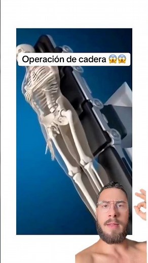 Así es como se realiza una operación de cadera