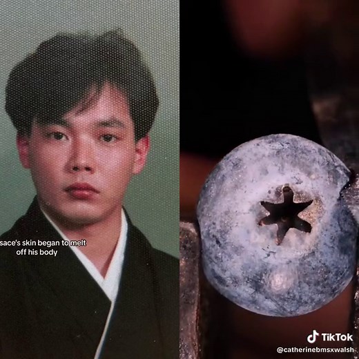 The Horrific Hisashi Ouchi Case: The Most Radioactive Man in History