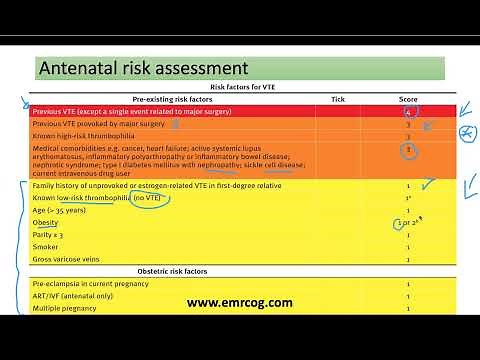 Key points of RCOG Guideline Reducing the Risk of VTE during Pregnancy and the Puerperium (No. 37a)