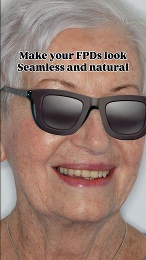 How to easily create natural looking Fixed dental bridges for front teeth #dentalhacksdentists