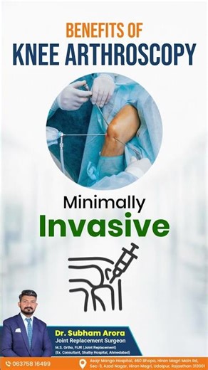 BENEFITS OF KNEE ARTHROSCOPY