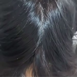 Scratch no more! This Australian made, all natural, luxury Shampoo stops itching and flaking. Key ingredents include Green Tea extract, ACV and Blue-Green Algae amno acids to balance the scalp. Vegan and Cruelty Free. ps It smells AMAZING! 🌿Created by Sydney Hairdresser Natasha Jay 🌿No Silicone, Sulphate, Paraben or Palm Oil 🌿Vegan. PETA certified Cruelty Free. No animal testing 🌿Free 2-4 day Delivery Options Worldwide | Pump Haircare