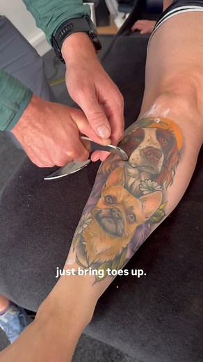 5.1K views · 200 reactions |  Treating Shin Splints with IASTM: Pin...