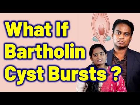 What Happen If Bartholin Cyst Abscess Burst ? Vaginal Cyst Vestibular Gland Cyst Homeopathy Medicine
