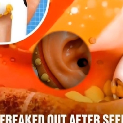 Why Constant Earbud Use Could Be Riskier Than You Think REASON WHY IS IN THE COMMENTS BELOW ⬇️ | Scratcherchallenge