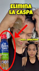 Elimina la caspa✨ #reelsviralシ #tips #cabello #Caspa #cleaning #viralpost | Paola Alvarez