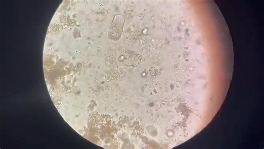 Stool sample 😍 #MedicalLabTechnician #lablife | Lab life