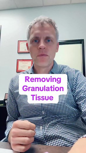 9.8K views · 309 reactions | You need to remove granulation tissue from a tooth extraction otherwise it’ll just keep bleeding. Here are three solutions to this problem. #oralsurgery #dentalschool #dentistoffice #dentalhygiene #tooth #dentalassistant | Bert Walpack | Facebook